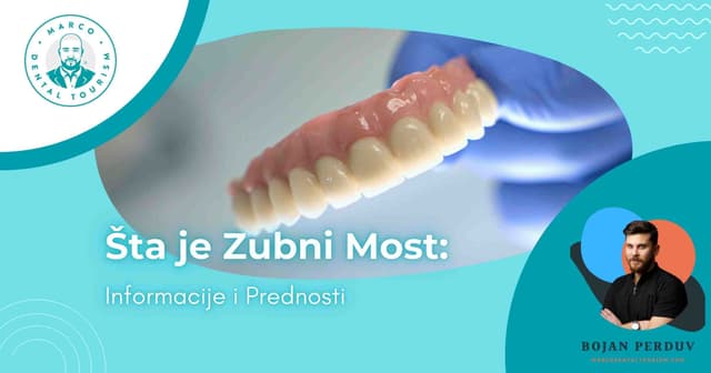 Zubni most | Kako se rade mostovi na zubima? | Marco Dental